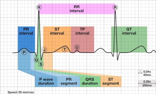 ACLS Rhythms and Interpretation - Advanced Medical Certification